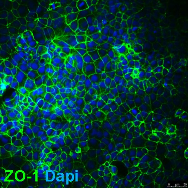 Caco-2/TC-7 Human Colon Adenocarcinoma Cell Line | SCC209